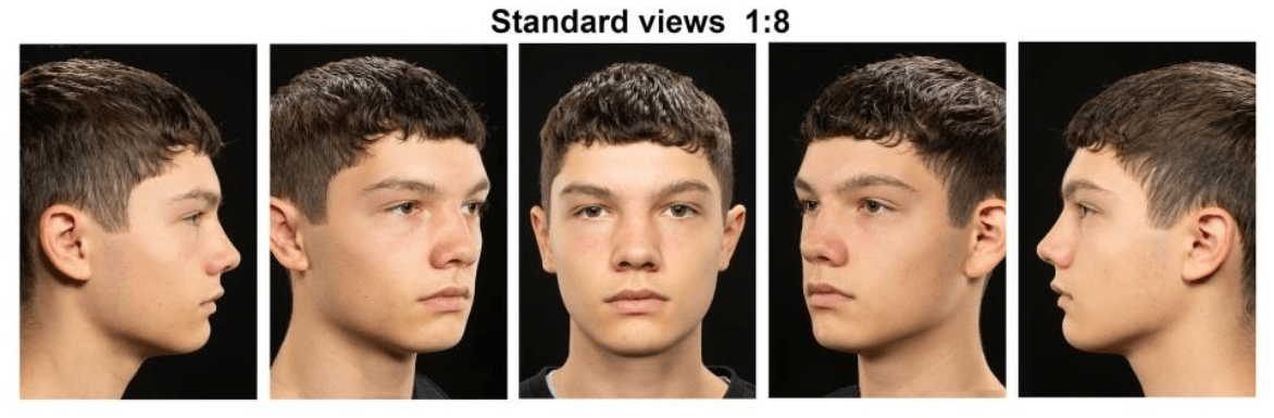 Taking your photo views - Mr Jeet Rao | Facial Surgeon